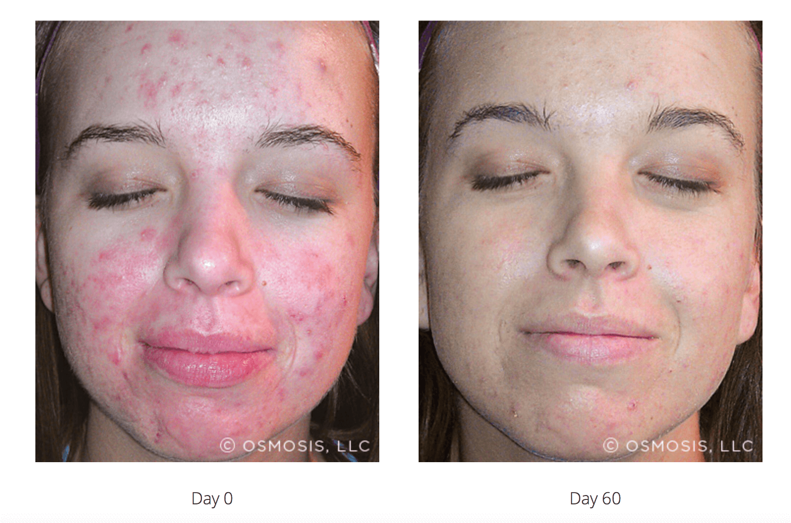 Skin Conditions - Simplicité
